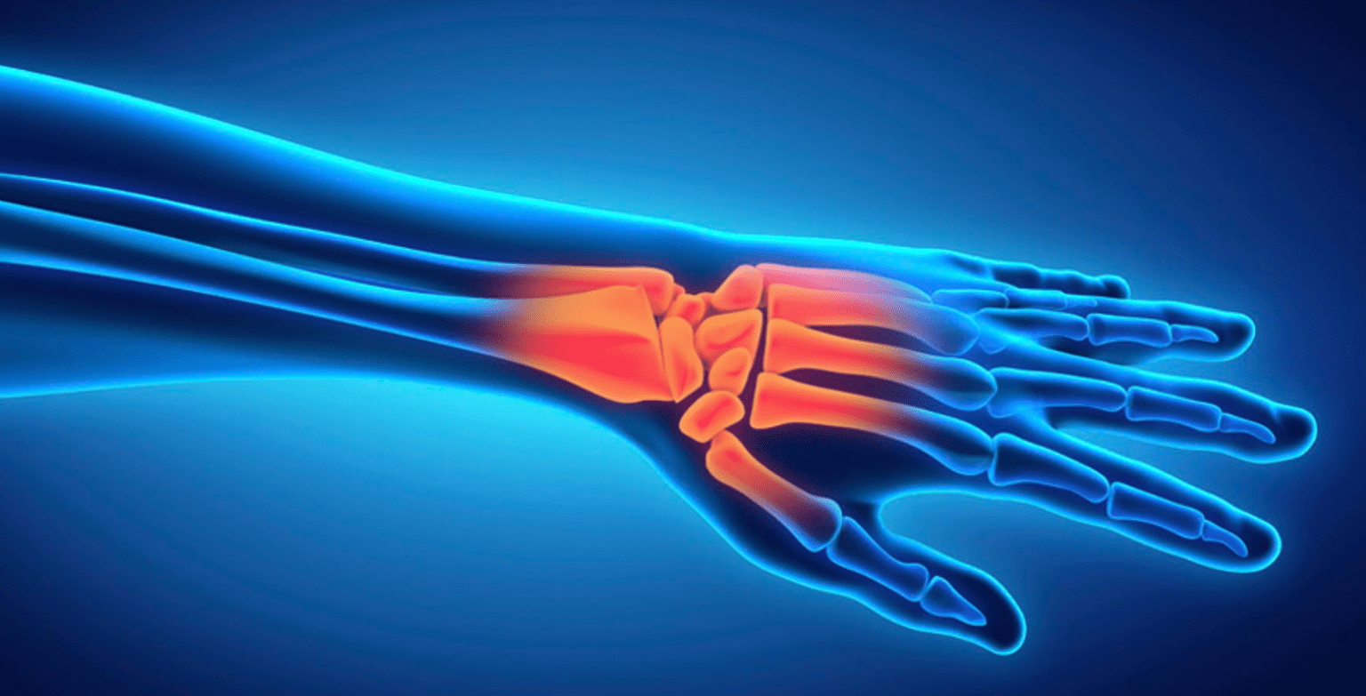 Repetitive Strain Injuries Guide - Aston Knight Solicitors